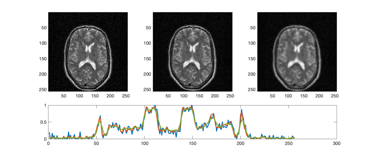 General Imaging Characteristics - Medical Imaging for Undergrads