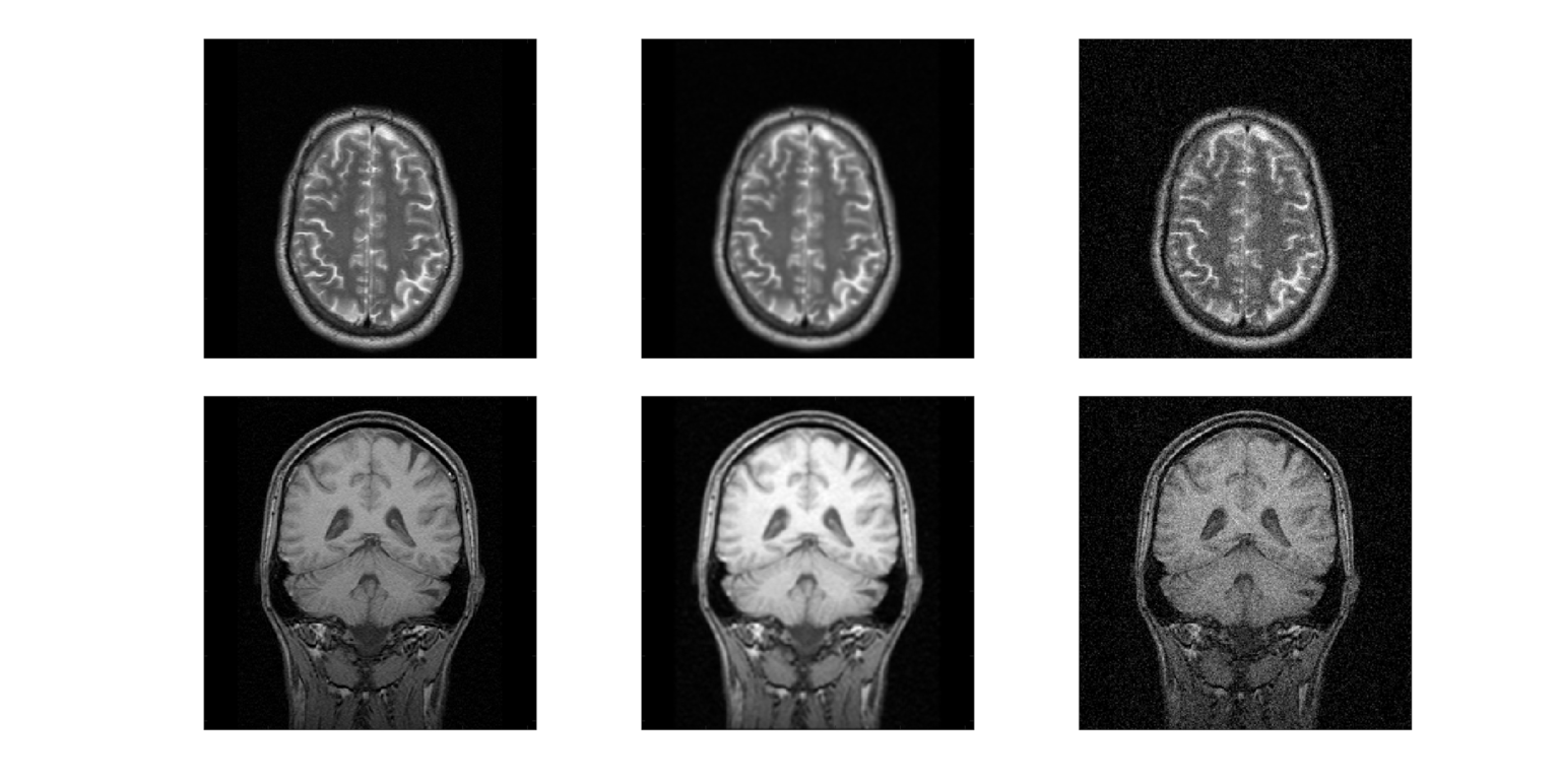 General Imaging Characteristics - Medical Imaging for Undergrads